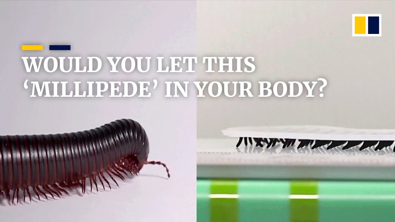 Would you let this 'millipede' in your body? - The Global Herald