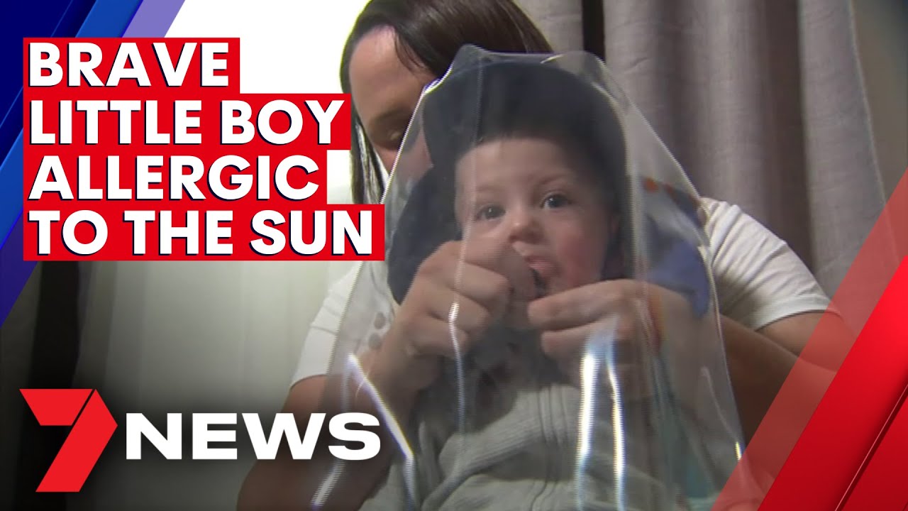 Brave little boy allergic to the sun | 7NEWS - The Global Herald