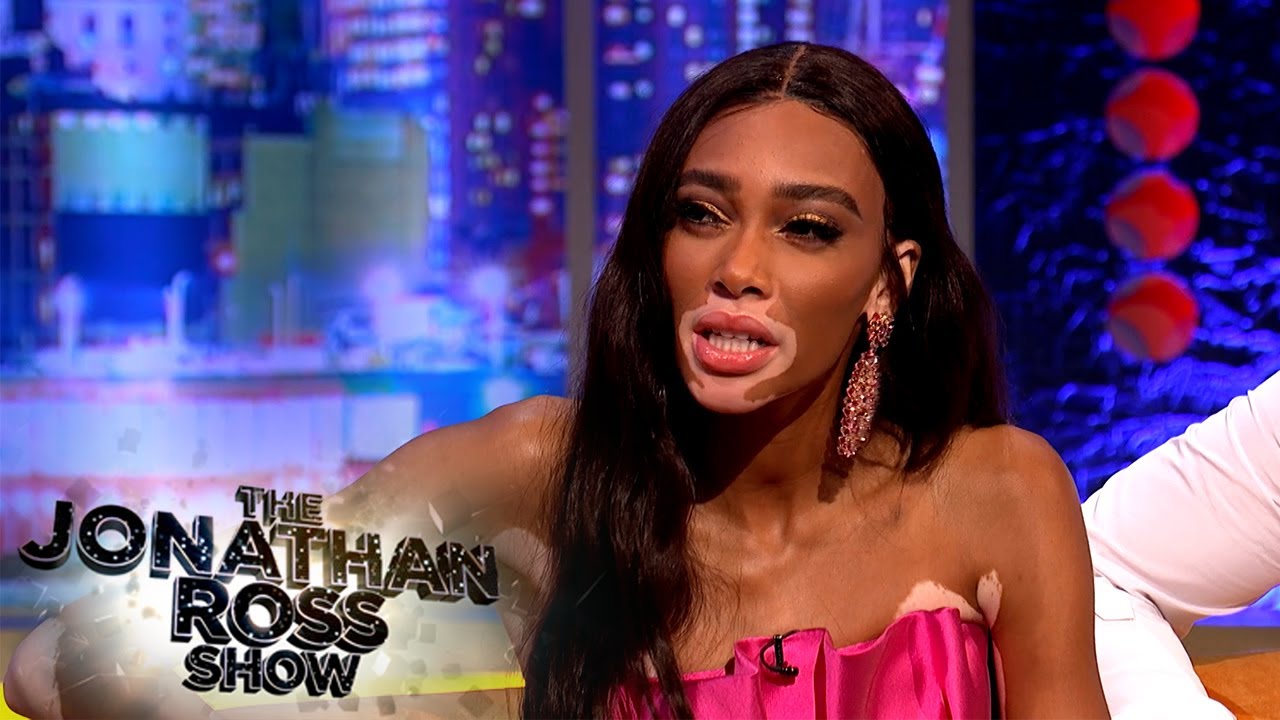 Winnie Harlow's First Casting Call Made Her Stronger | The Jonathan ...