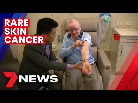 The rare but deadly skin cancer that’s on the rise | 7NEWS - The Global ...