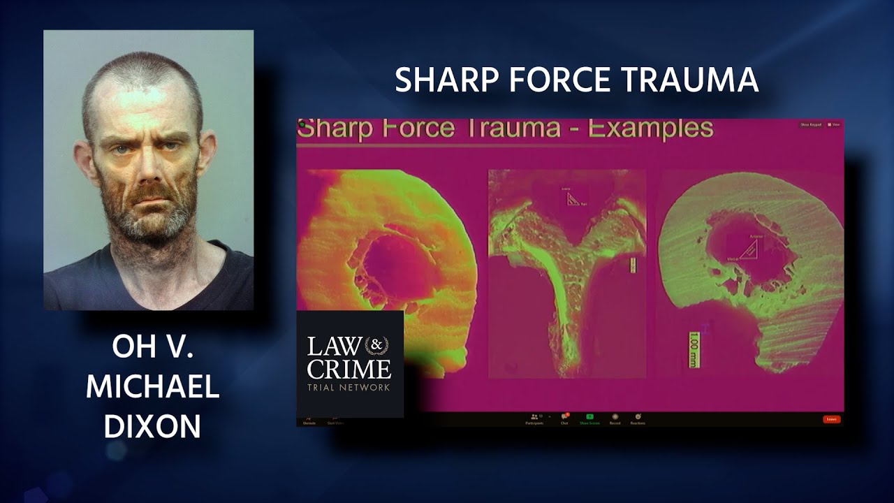 OH v. Michael Dixon Trial Day 4 - Explanation of Sharp Force Trauma ...