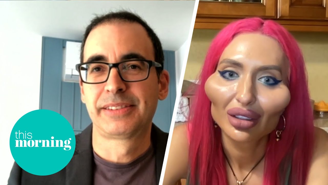 Cosmetic Surgeon Says 'Alien-Like' Facial Surgery Has Gone Too Far ...