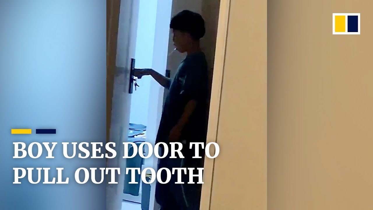 Boy uses door to pull out tooth in China - The Global Herald