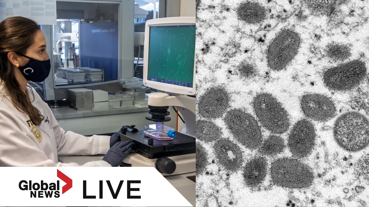 Monkeypox: Canadian health officials provide update on cases, response ...