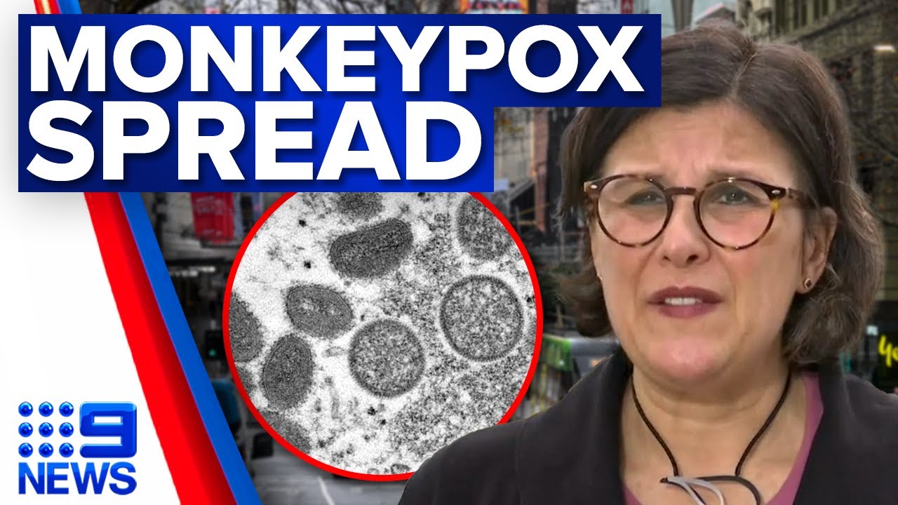 Monkeypox virus spreading in Melbourne | 9 News Australia - The Global ...