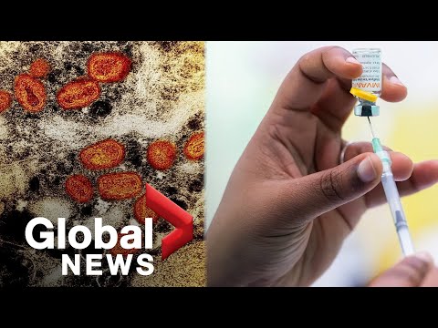 Experts urge Canadian officials to take more action on monkeypox spread ...