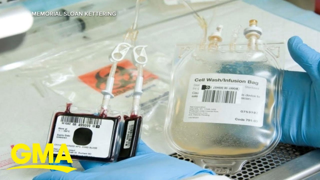 How 'cord blood’ is helping bone marrow transplant research - The ...