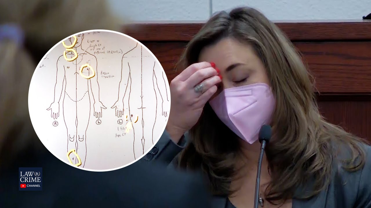 Extreme Skier Murder Trial: Autopsy Drawing Depicts Victim's Gunshot ...