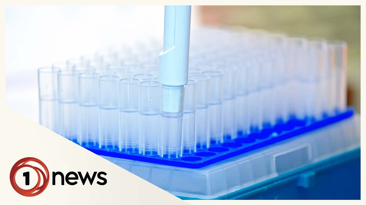 New Antibody Test Can Tell If You Ve Had Covid The Global Herald