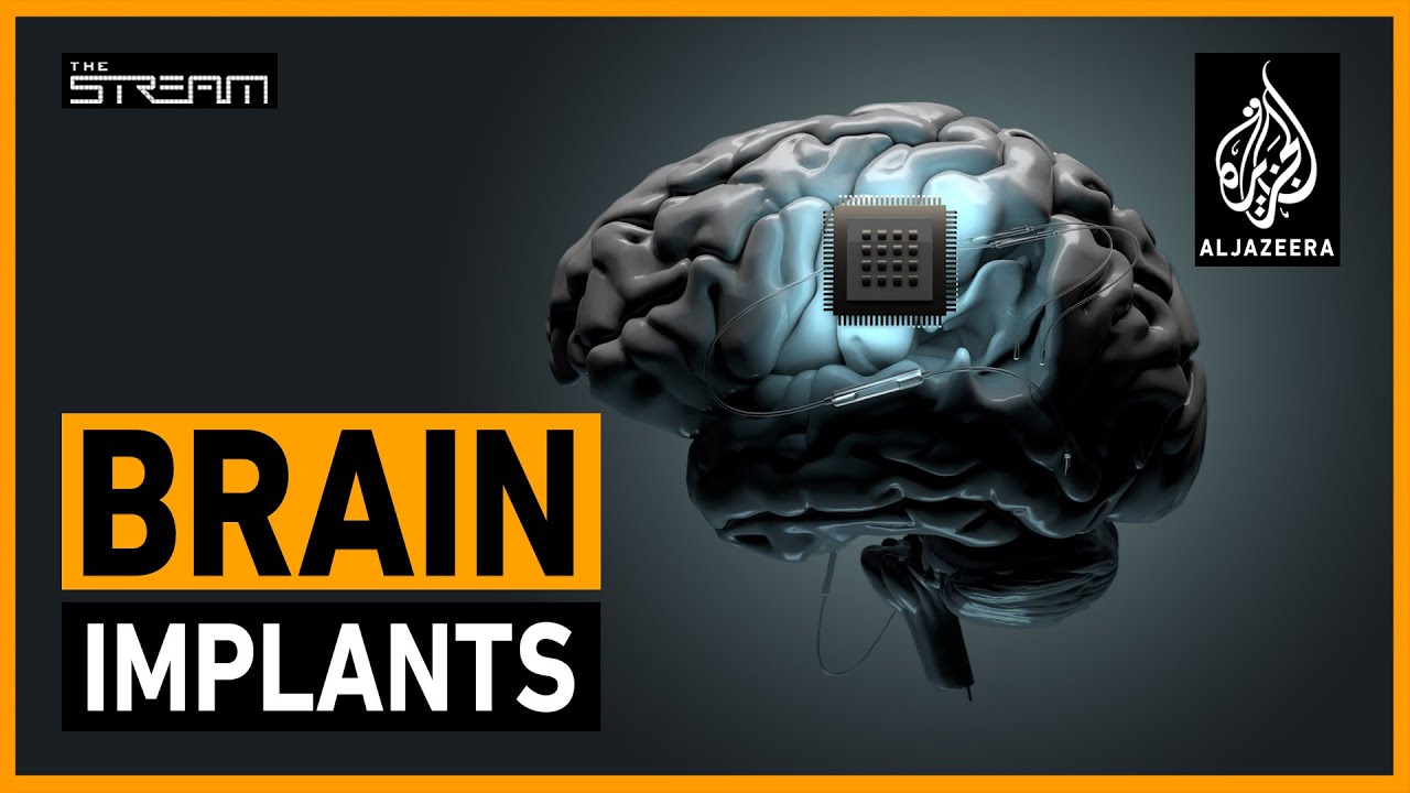 What does the future hold for brain implant technology? | The Stream ...