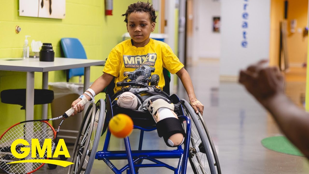 Michigan boy had both of his legs amputated after strep and influenza A ...