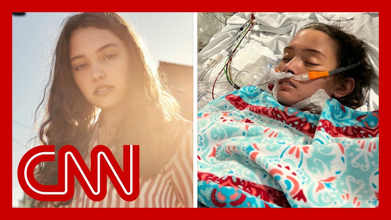 21-year-old model becomes double-amputee after severe illness - The ...