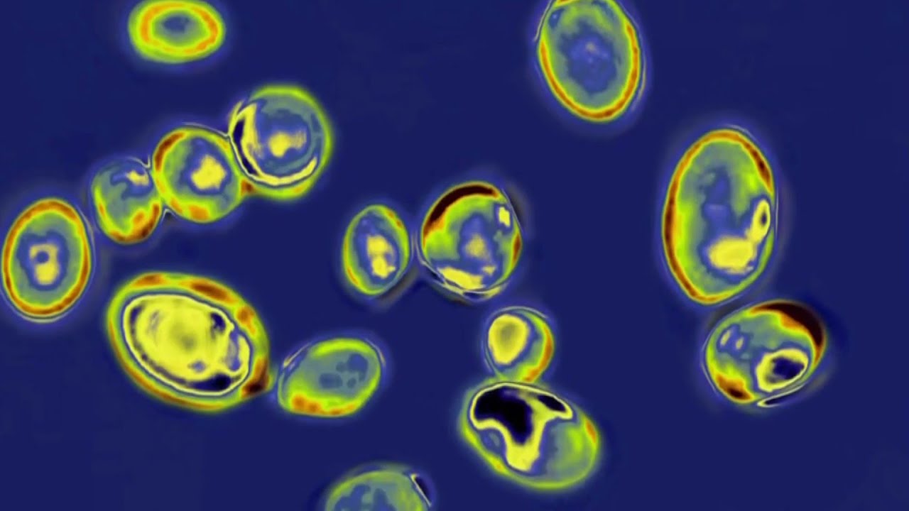 CDC warns of spike in U.S. cases of deadly fungal infection - The ...