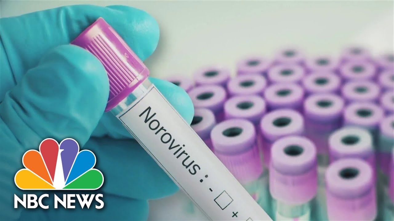 Norovirus cases spike in both kids and adults - The Global Herald