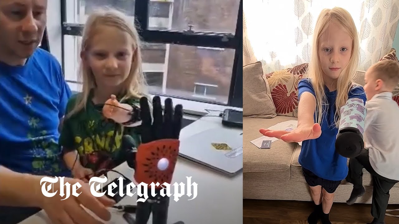 Six-year-old girl born with no fingers set to be the youngest in the UK ...