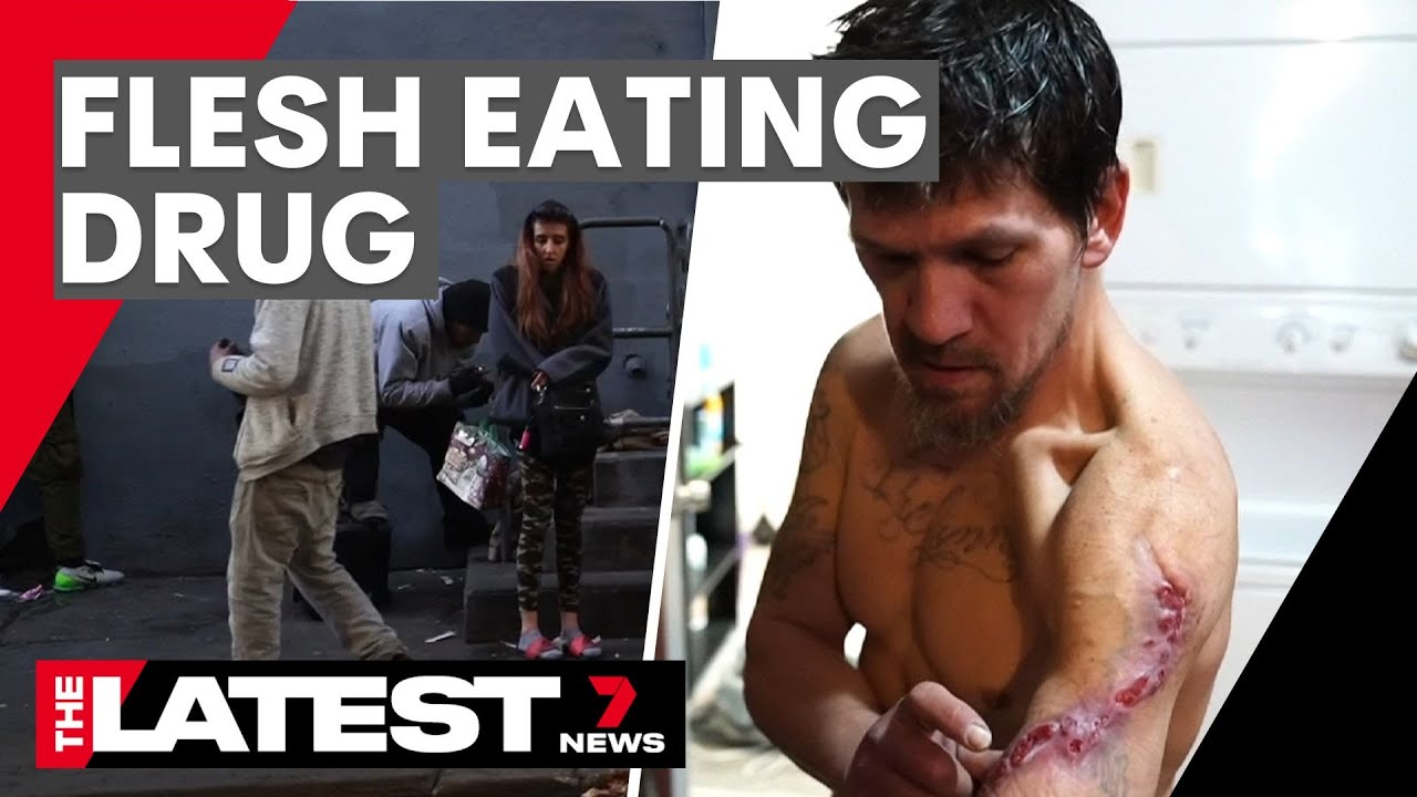 The flesh-eating drug taking over America | 7NEWS - The Global Herald