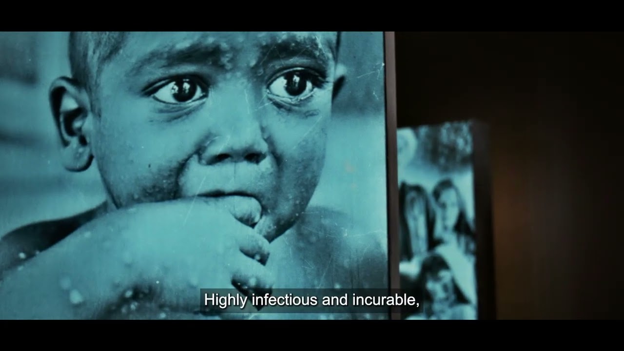 Smallpox eradication : Science, solutions, solidarity - The Global Herald