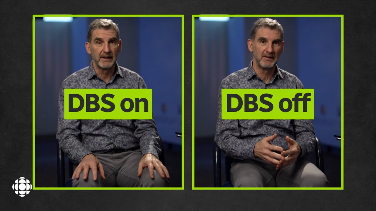 Watch how a device in his chest helps manage his Parkinson’s disease ...