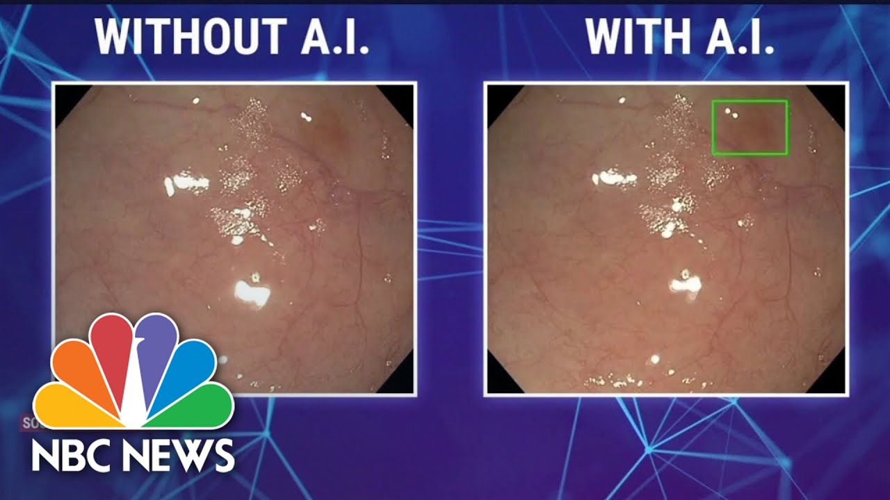 How A.I. is helping doctors detect cancer - The Global Herald