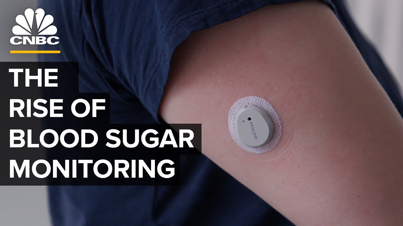 How Dexcom And Abbott Are Moving Beyond Diabetes - The Global Herald