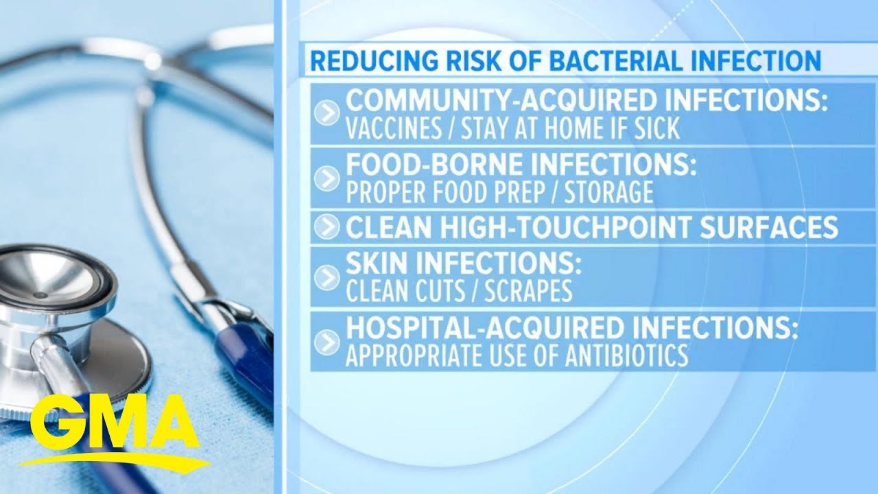 What to know about bacterial infection - The Global Herald