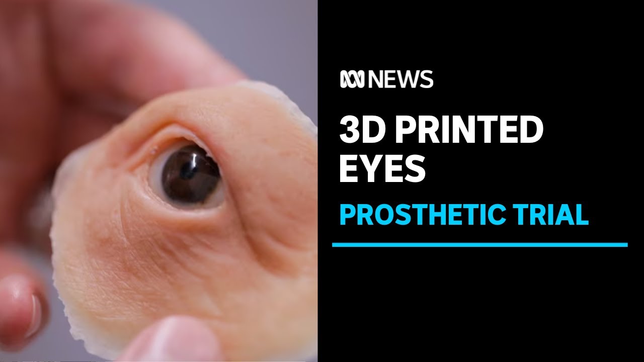 The new 3D printing technology revolutionising artificial eyes for ...