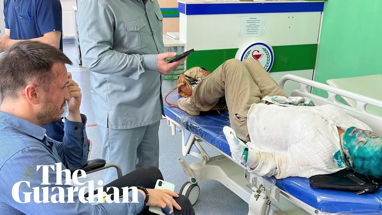 Prominent Russian journalist brutally attacked in Chechnya - The Global ...