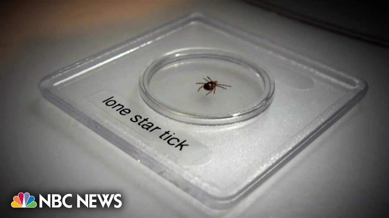 Alpha-gal syndrome has afflicted thousands, CDC says 42% of doctors ...