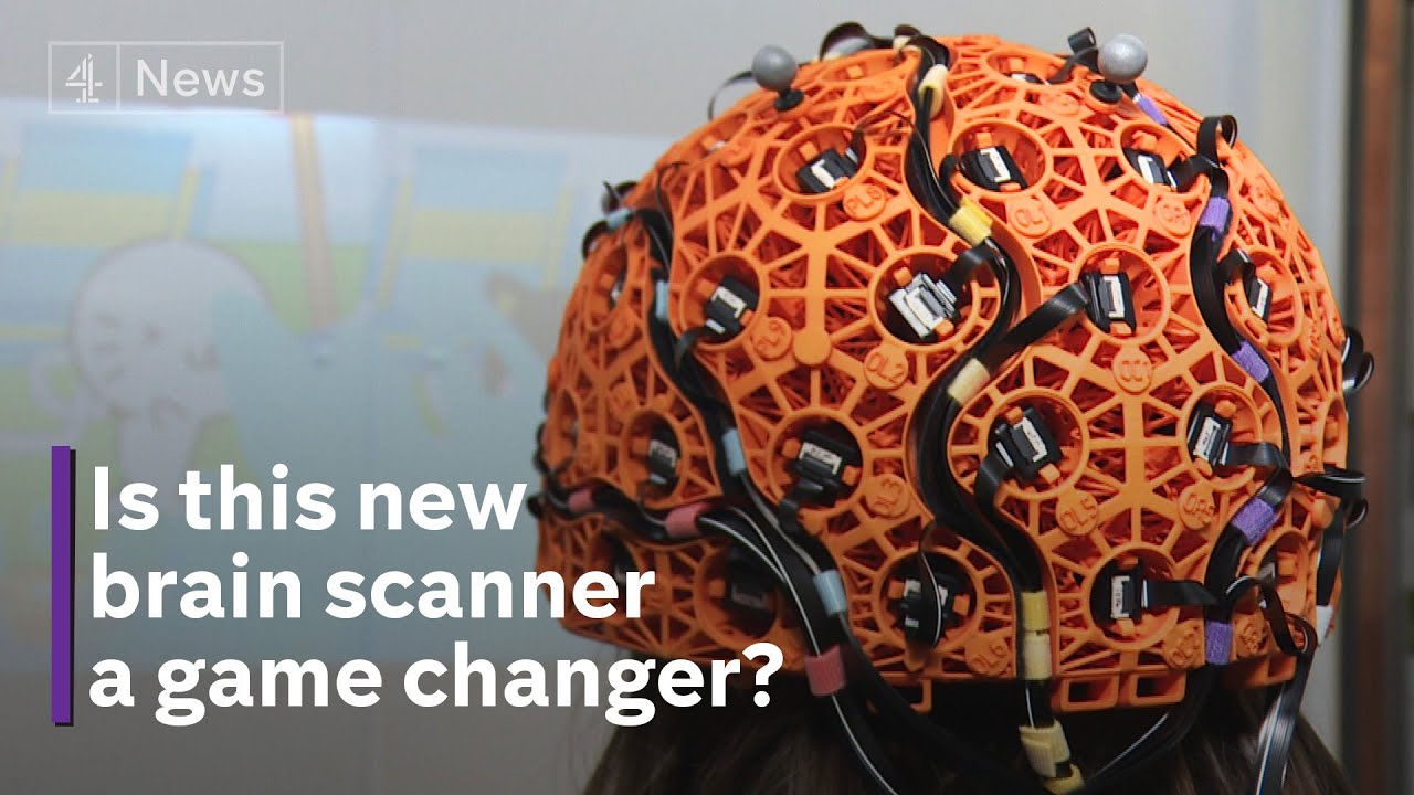 New brain scanner could revolutionise treatment of children with ...