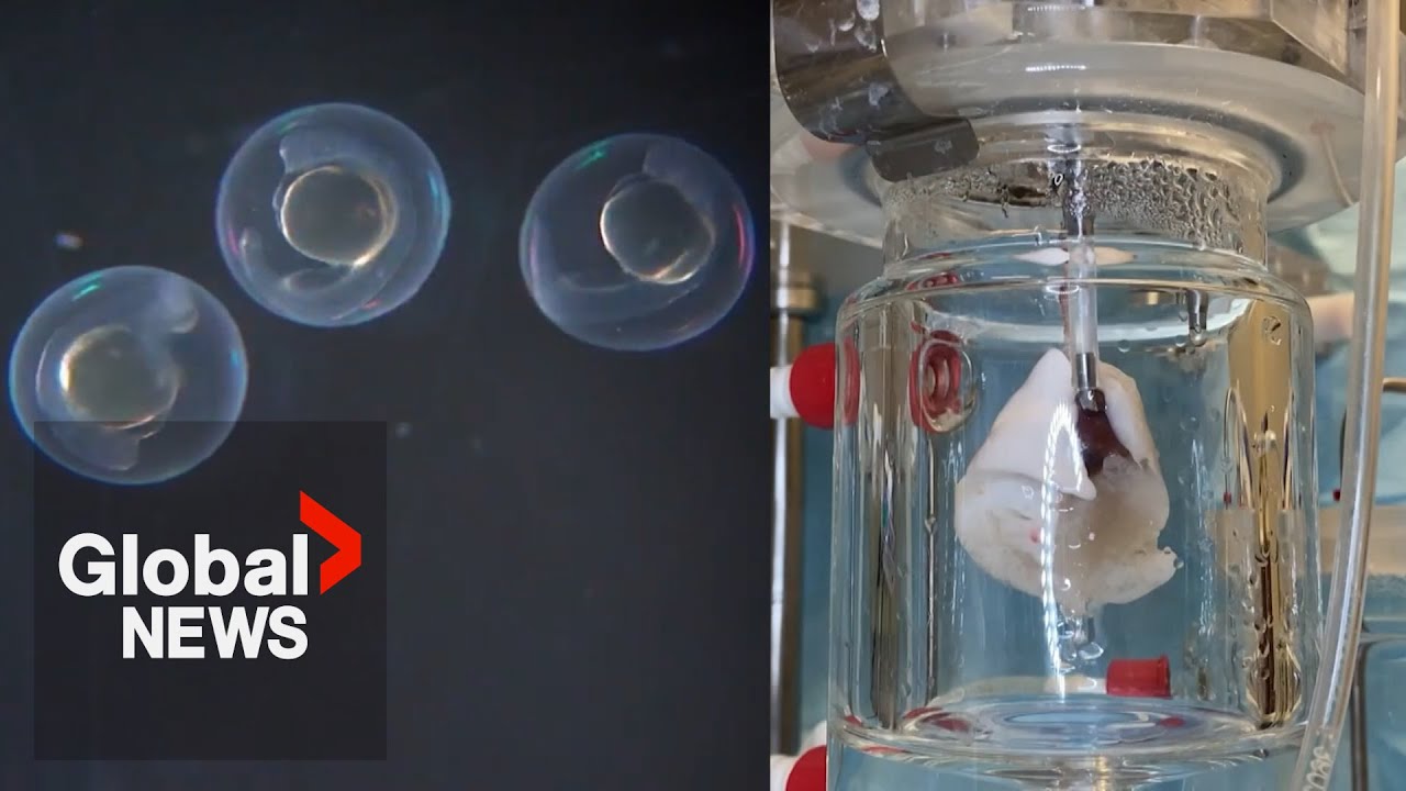 Cryopreserving organs: University of Alberta scientists search for ways ...