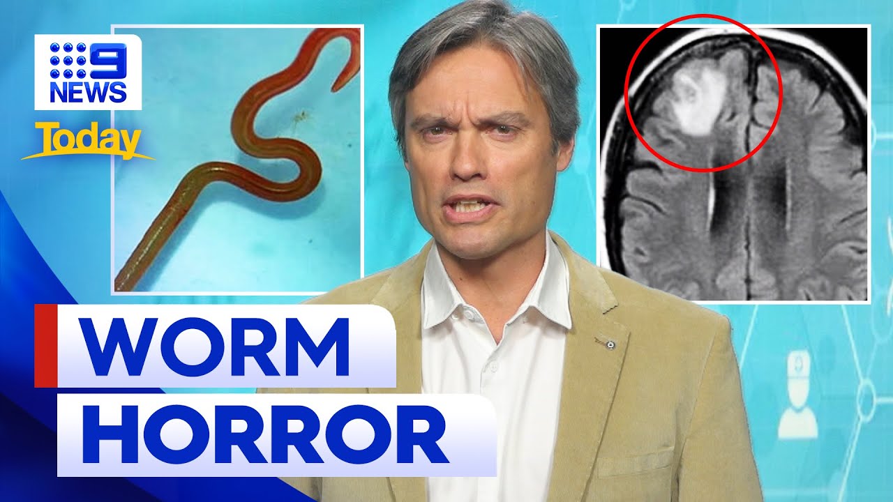 World first discovery: Medical experts find live worm in NSW woman's ...