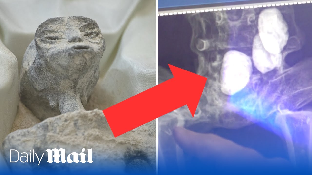 Alleged ‘alien autopsy’ in Mexico: CT scan unveiled body of 'non-human ...