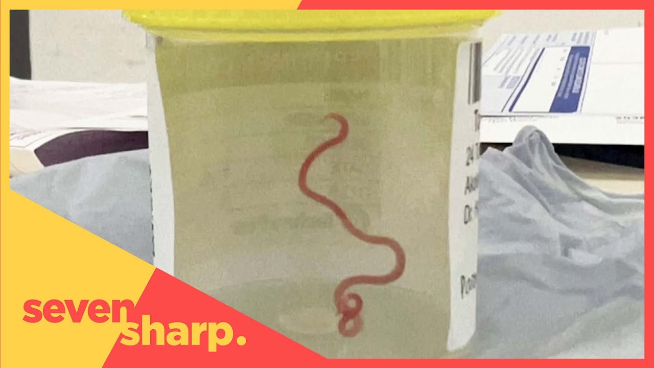 The worm that turned - The Global Herald