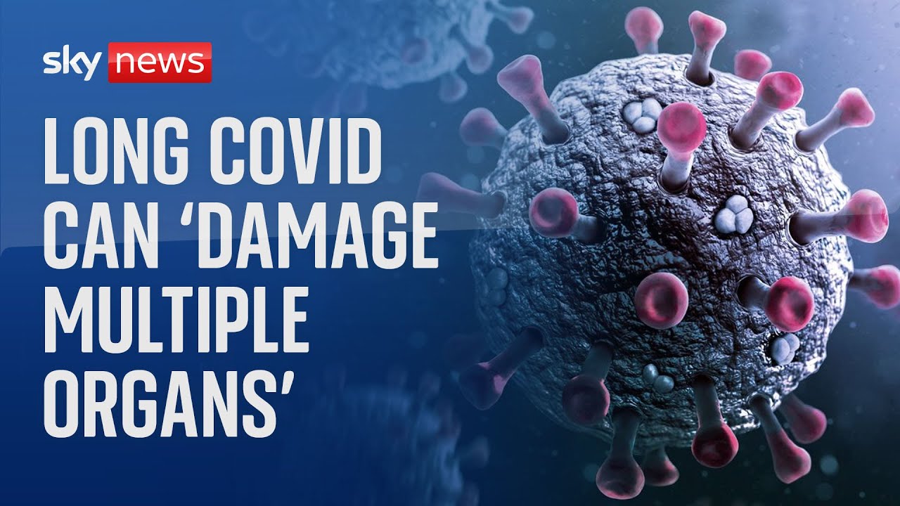 Long COVID can cause long-term damage to multiple organs, study finds ...