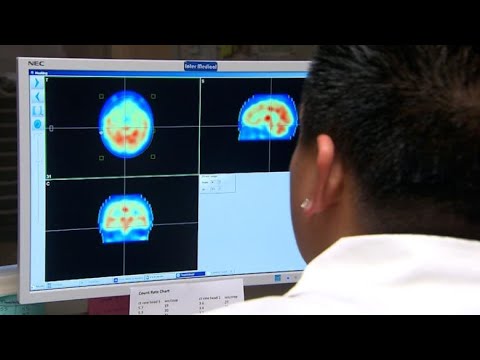 The health benefits of regular naps - The Global Herald