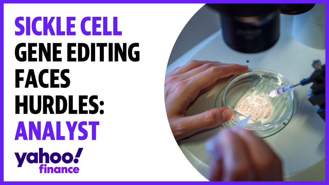 Sickle cell gene editing faces market hurdles: Analyst - The Global Herald