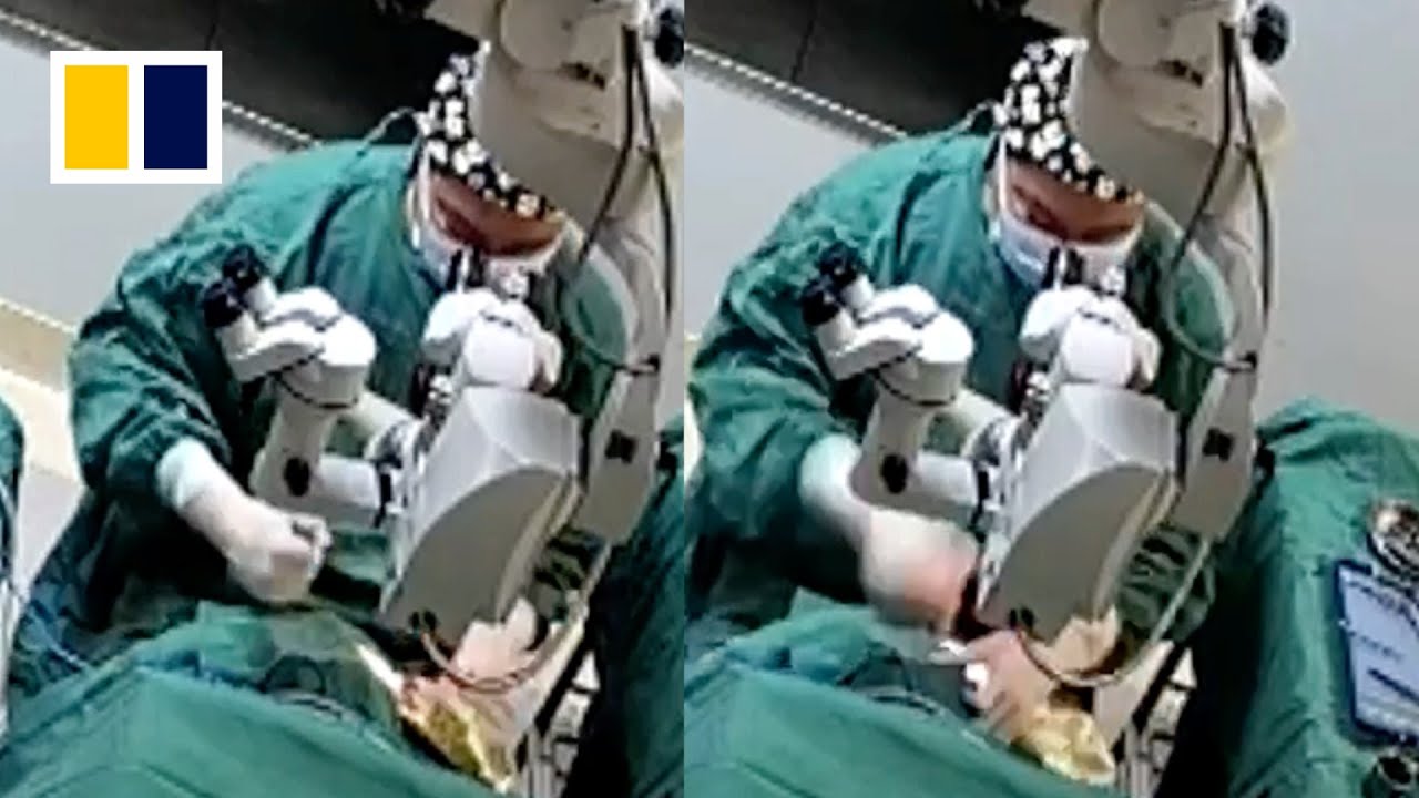 Doctor suspended after punching patient’s head in surgery - The Global ...
